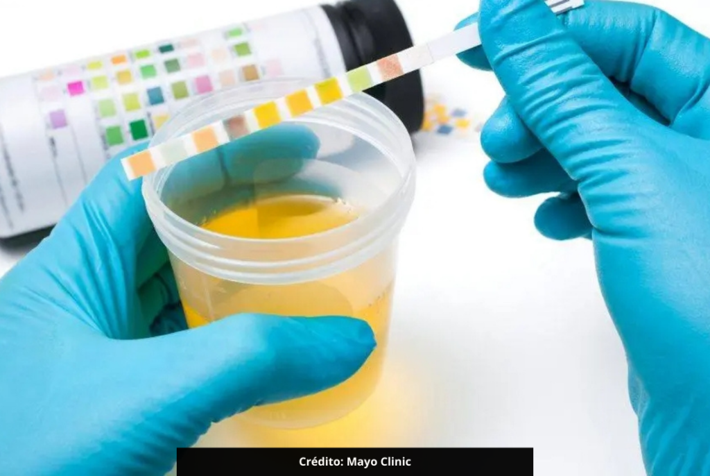 Entenda os perigos da infecção urinária - Jornal Folk